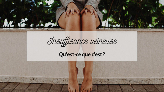 L’insuffisance veineuse : c’est quoi ? - La Boutique des Jambes