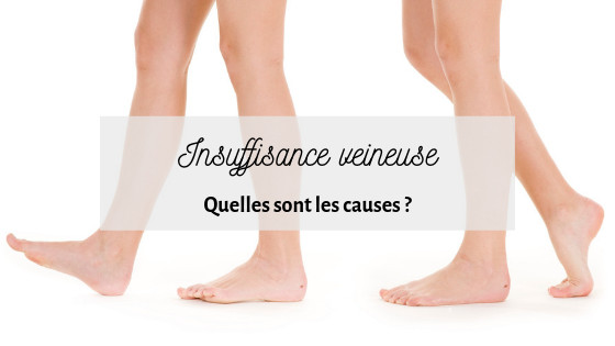 Découvrez les 12 principales causes de l’insuffisance veineuse ! - La ...